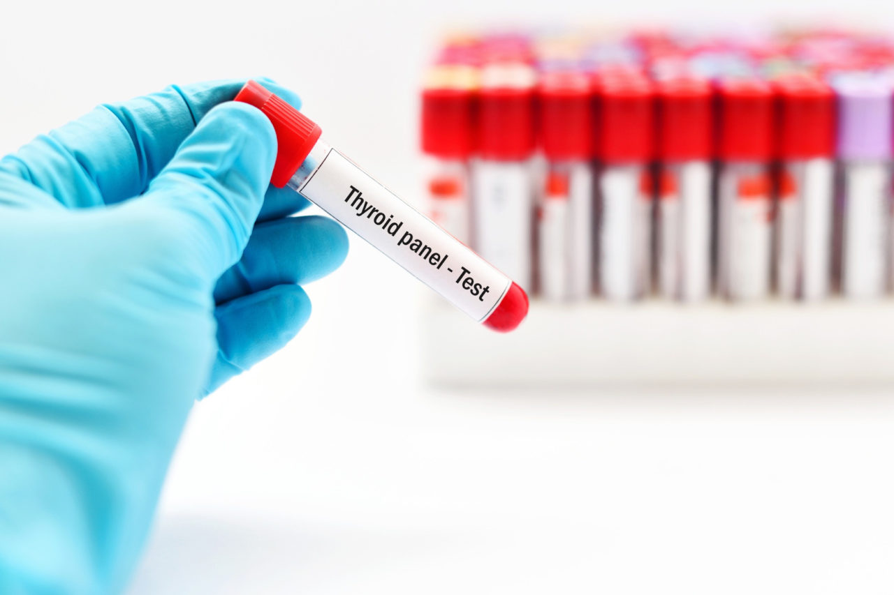 Thyroflex – The Most Advanced Thyroid Function Test